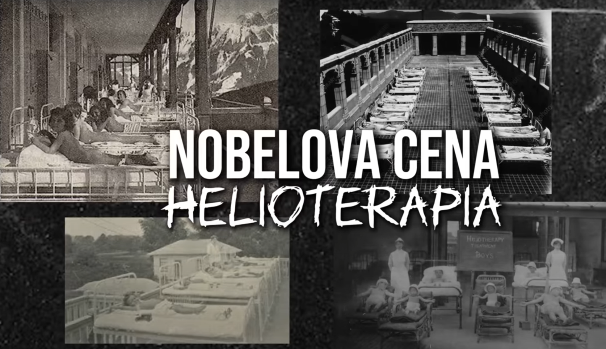 liecba-slnkom-helioterapia-slnko-oplalovanie – Znanie